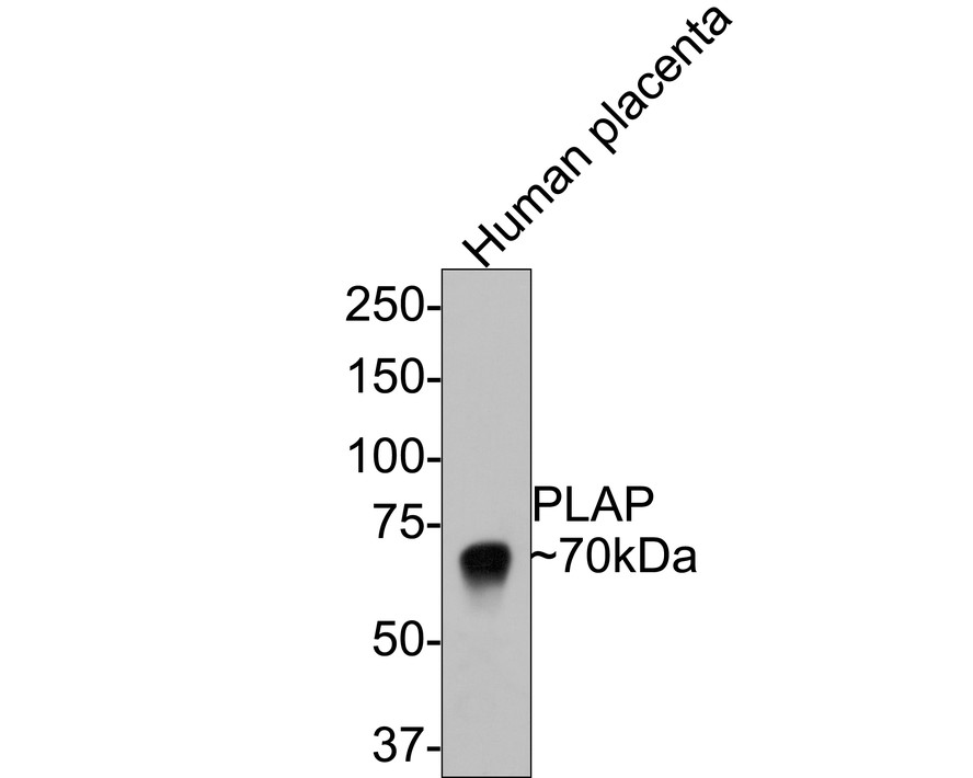 Placental alkaline phosphatase (PLAP) Recombinant Rabbit Monoclonal An ...