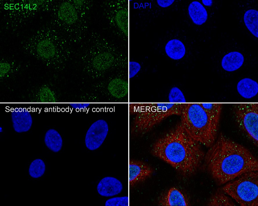 SEC14L2 Recombinant Rabbit Monoclonal Antibody [JE61-74] (HA721366 ...