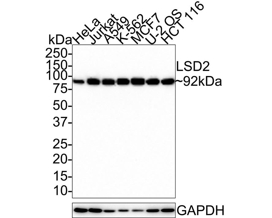 LSD2 Recombinant Rabbit Monoclonal Antibody [JE32-40] (HA721462) – HUABIO