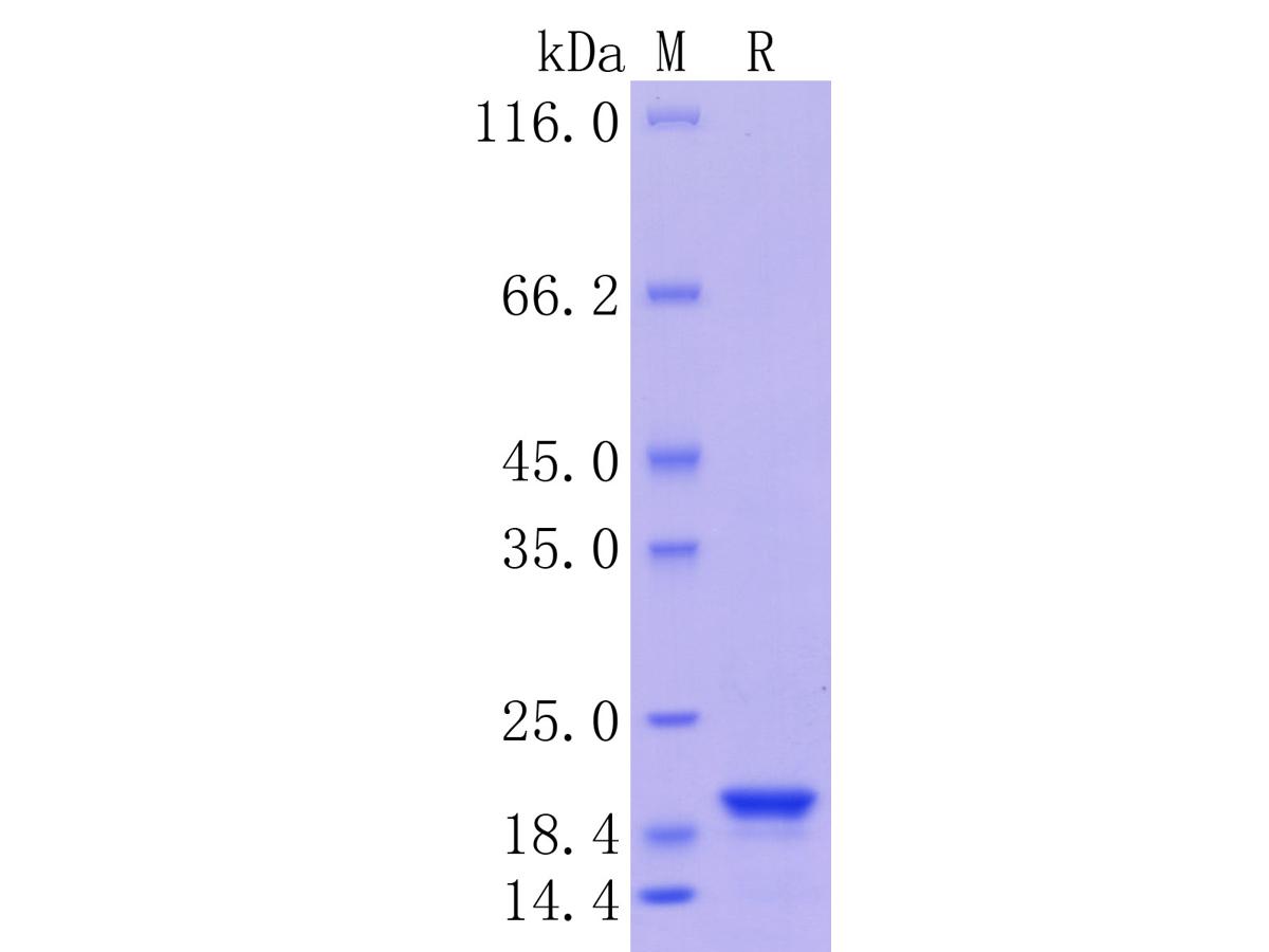 Human ZO1, N-Twin Strep, C-His, Flag Tag Protein (HA210528) – HUABIO