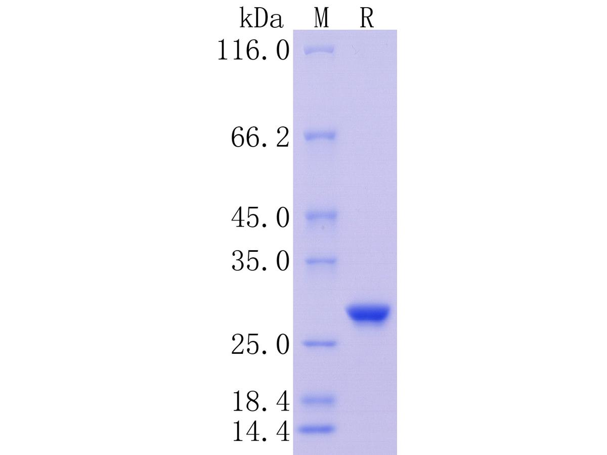 Human EIF3K, N-Twin Strep, C-His, Flag Tag Protein (HA210535) – HUABIO