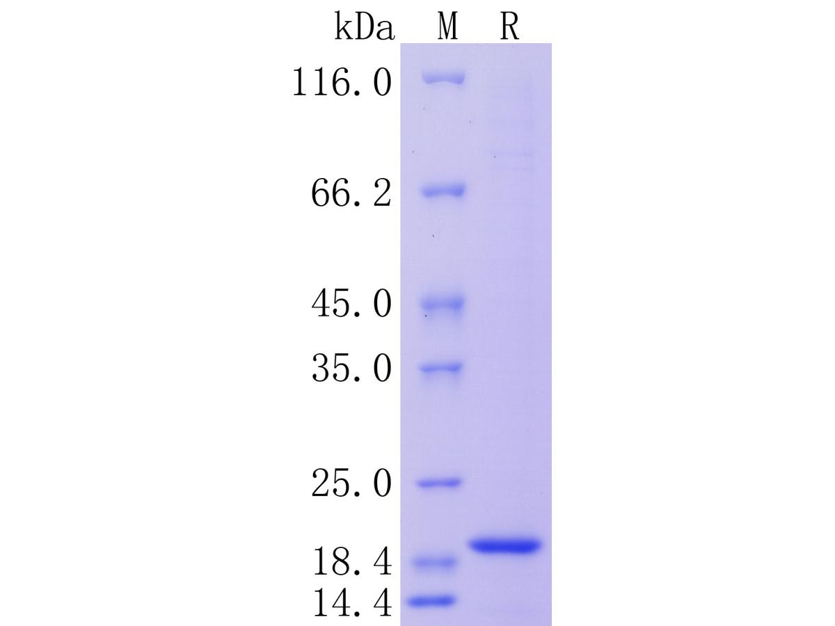 Human IL-21, C-His, Flag Tag Protein (HA210578) – HUABIO