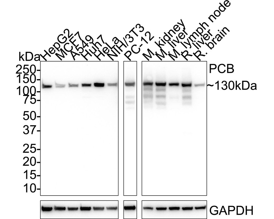 PCB Recombinant Rabbit Monoclonal Antibody [PSH01-55] (HA721698) – HUABIO