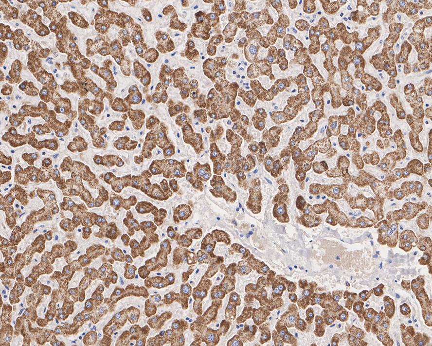 SLC25A38 Recombinant Rabbit Monoclonal Antibody [PSH02-79] (HA721857 ...