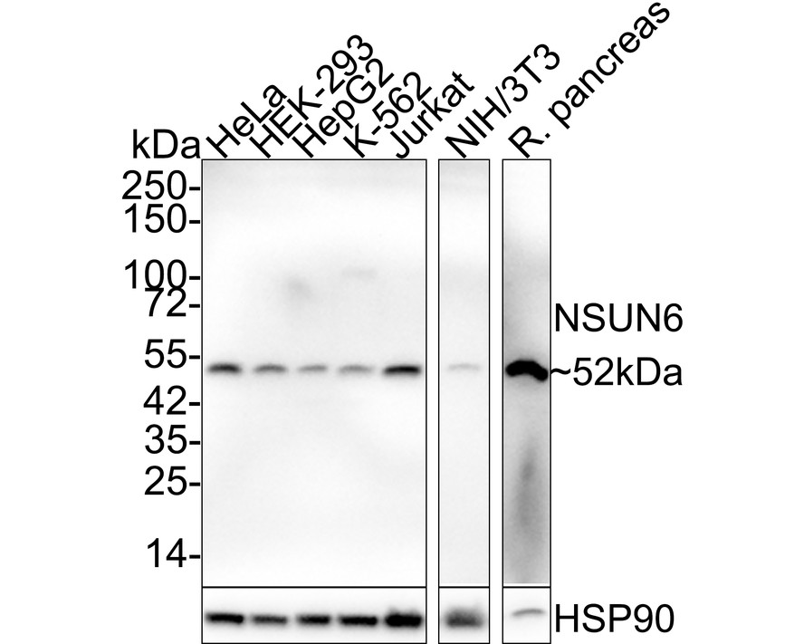 NSUN6 Recombinant Rabbit Monoclonal Antibody [PSH02-80] (HA721858) – HUABIO