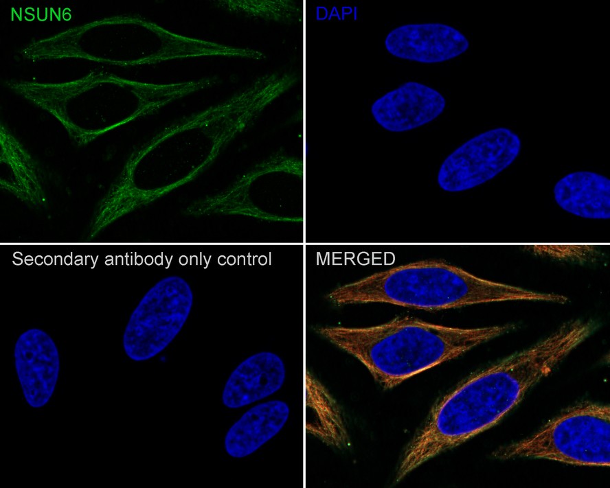 NSUN6 Recombinant Rabbit Monoclonal Antibody [PSH02-80] (HA721858) – HUABIO