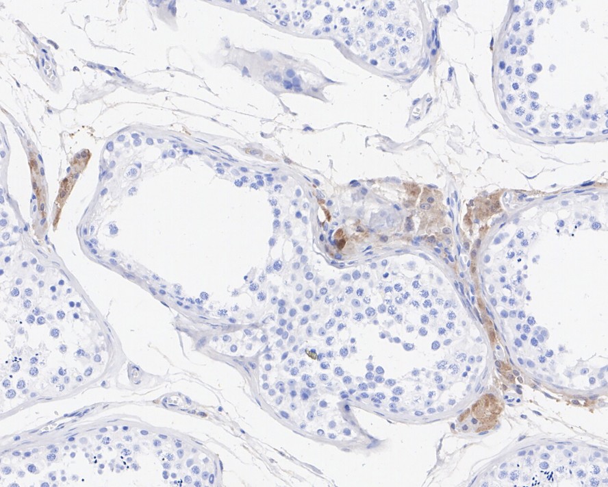 GST3 Recombinant Mouse Monoclonal Antibody [11D5-R] (HA601272) – HUABIO