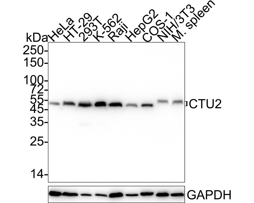 CTU2 Recombinant Rabbit Monoclonal Antibody [PSH04-05] (HA722086) – HUABIO