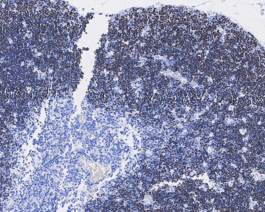 ROR gamma T Recombinant Rabbit Monoclonal Antibody [PSH04-38] (HA72212 – HUABIO