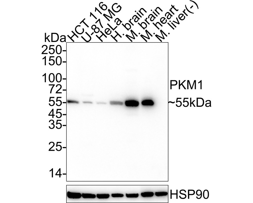 PKM1 Recombinant Rabbit Monoclonal Antibody [PSH04-37] (HA722120) – HUABIO