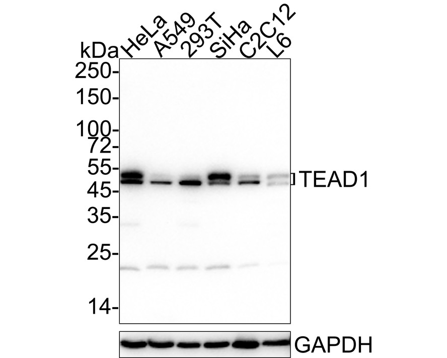 TEAD1 Recombinant Rabbit Monoclonal Antibody [JE45-37] (HA722144) – HUABIO