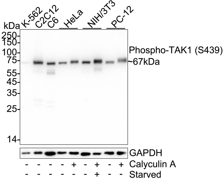 Phospho-TAK1 (S439) Recombinant Rabbit Monoclonal Antibody [JE44-93] ( – HUABIO