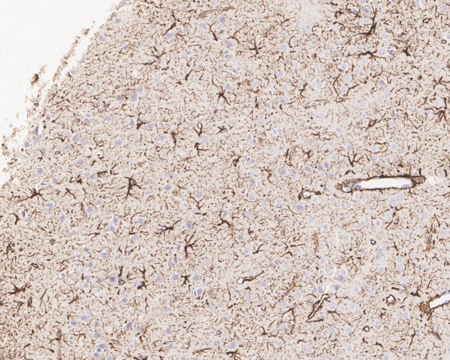 GFAP Mouse Monoclonal Antibody [1-D4] (EM140707) – HUABIO