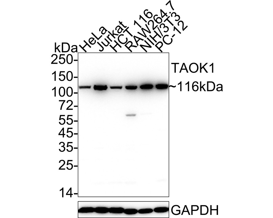 TAOK1 Recombinant Rabbit Monoclonal Antibody [JE65-14] (HA722473) – HUABIO