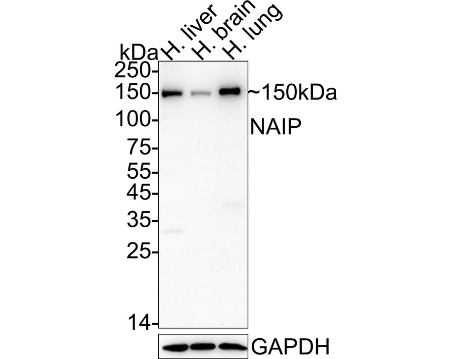 NAIP Recombinant Rabbit Monoclonal Antibody [JE39-24] (HA722550) – HUABIO