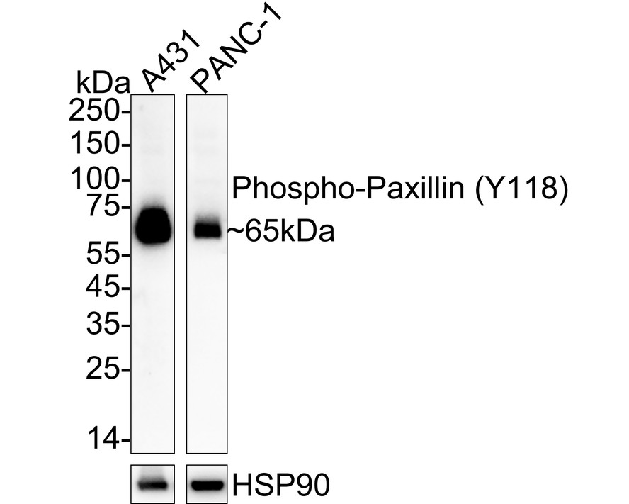 Phospho-Paxillin (Y118) Recombinant Rabbit Monoclonal Antibody [JE09-1 – HUABIO