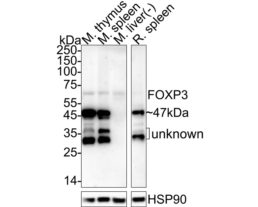 FOXP3 Recombinant Rabbit Monoclonal Antibody [PSH07-47] (HA722835) – HUABIO