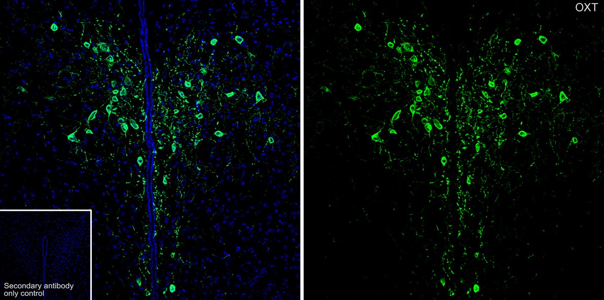 Oxytocin-neurophysin 1 / OXT Recombinant Rabbit Monoclonal Antibody [P ...