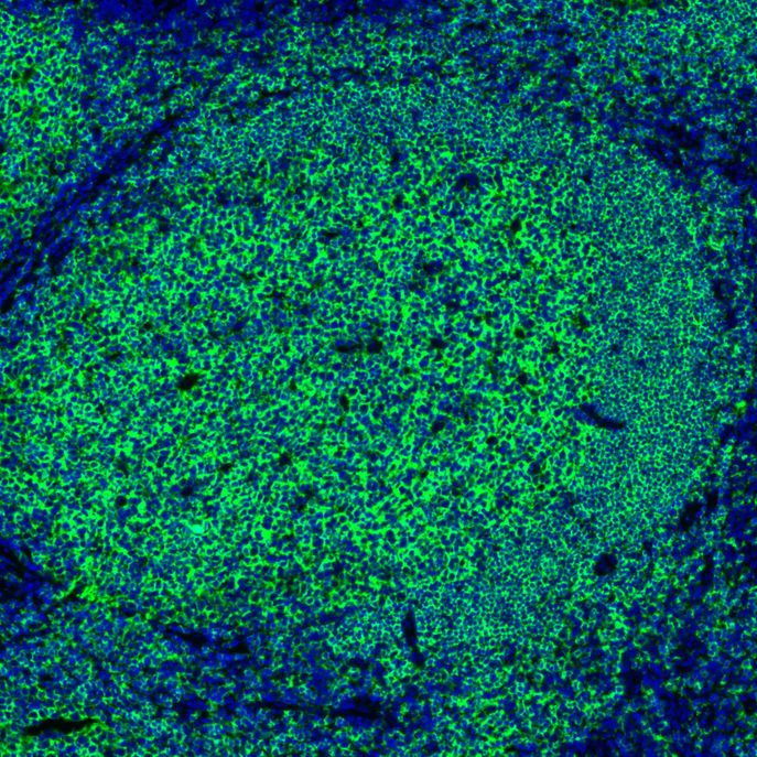 CD19 Recombinant Rabbit Monoclonal Antibody (IRS018) – HUABIO