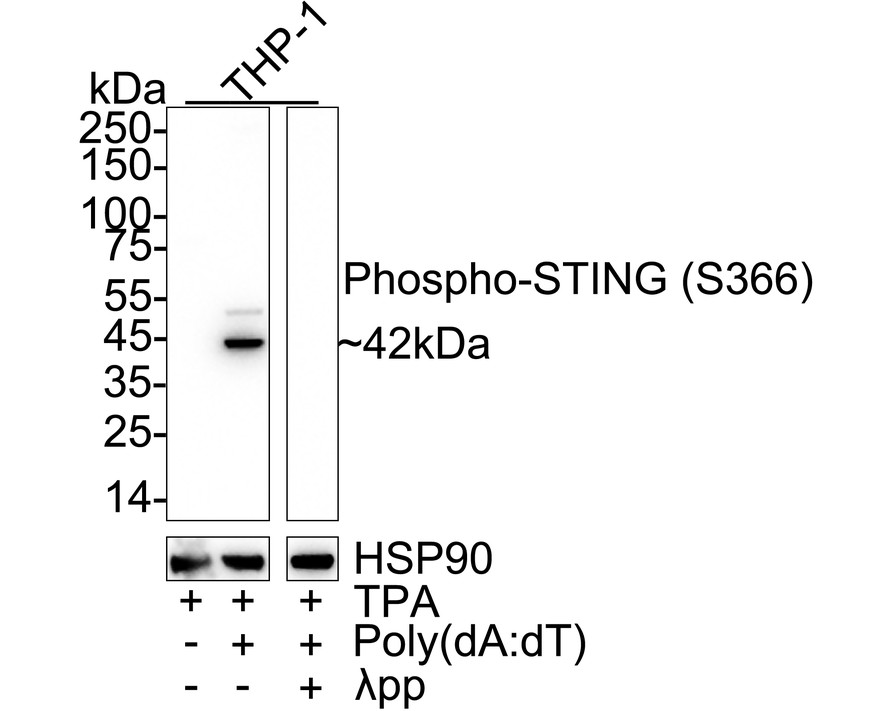 Phospho-STING (S366) Recombinant Rabbit Monoclonal Antibody [PSH09-72] – HUABIO