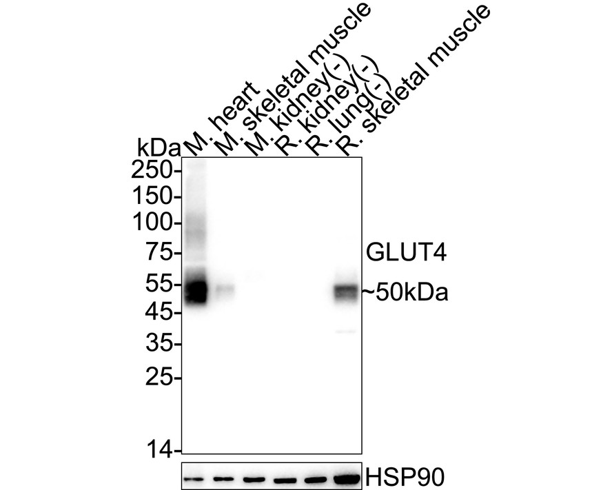 Glucose Transporter GLUT4 Recombinant Rabbit Monoclonal Antibody [PSH1 ...