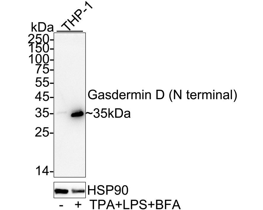 Gasdermin D (N terminal) Recombinant Rabbit Monoclonal Antibody [PSH10 – HUABIO