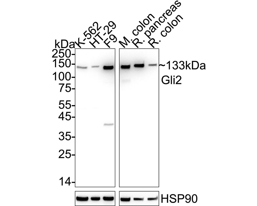 Gli2 Recombinant Rabbit Monoclonal Antibody [PSH11-23] (HA723305) – HUABIO
