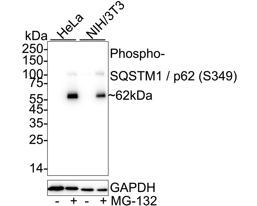p62/KEAP1/NRF2 Pathway Antibody Sampler Kit (HAK21140) – HUABIO