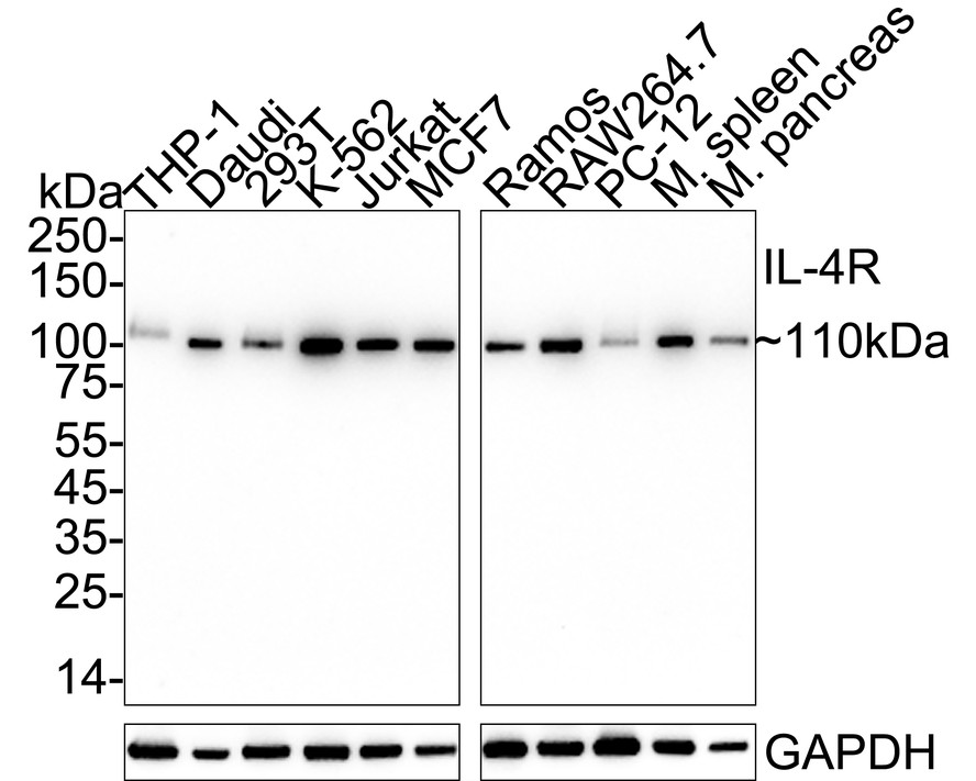 IL-4R Recombinant Rabbit Monoclonal Antibody - BSA and Azide free [PSH – HUABIO