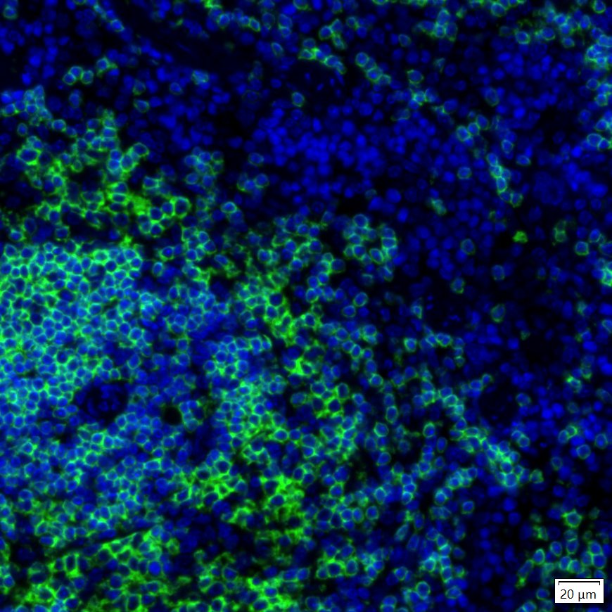 CD19 Recombinant Monoclonal Antibody (IRS110RB) – HUABIO