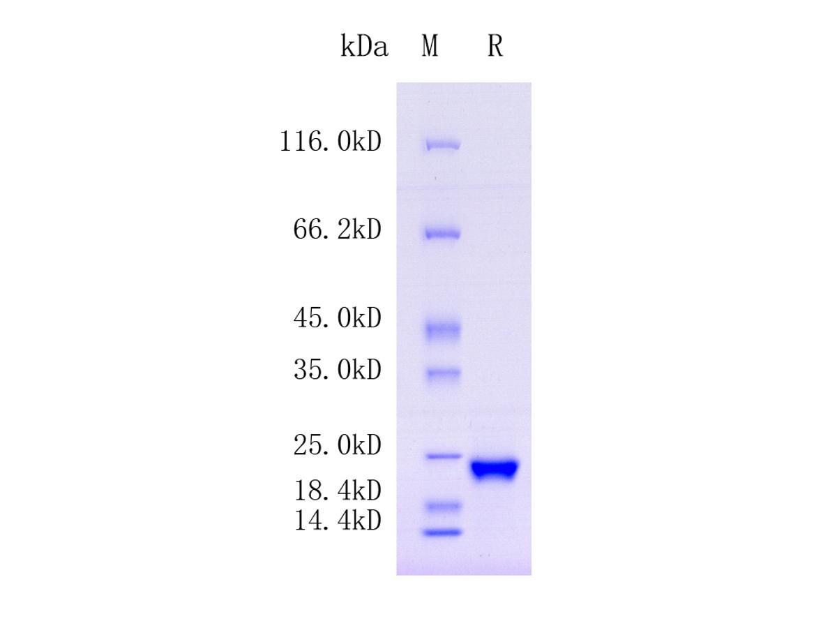 Human TIMP2, Tag Free Protein (HA211364) – HUABIO