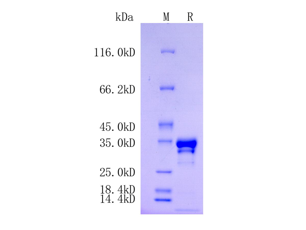 Human Thrombospondin-1/THBS1, Tag Free Protein (HA211369) – HUABIO