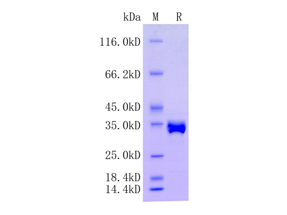Human ANGPTL4, Tag Free Protein (HA211387) – HUABIO