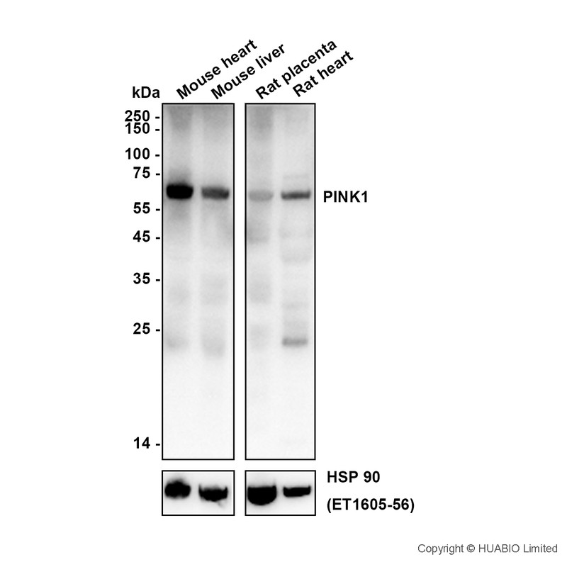 PINK1 Recombinant Mouse Monoclonal Antibody [PSH22-50] (HA601588) – HUABIO