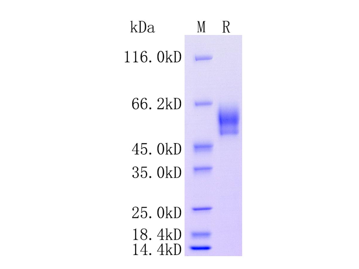 Human DKK-3, Tag Free Protein (HA211460) – HUABIO