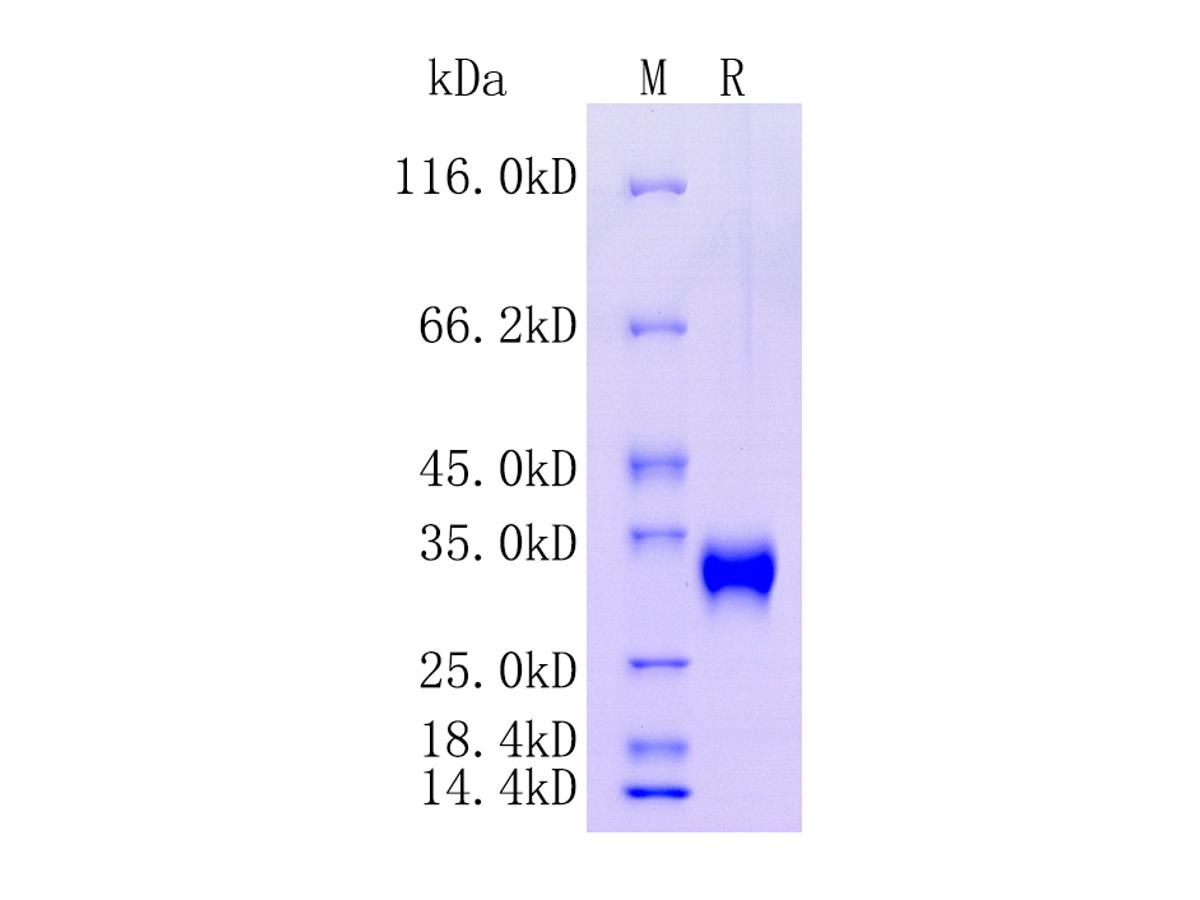 Human Bikunin/AMBP, C-His Tag Protein (HA211461) – HUABIO