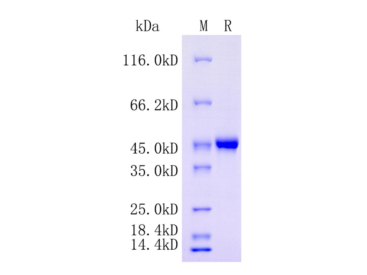 Human WIF1, Tag Free Protein (HA211467) – HUABIO