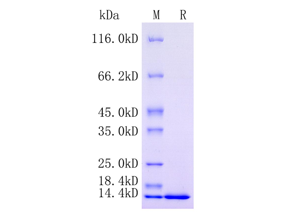 Human Cystatin B/CSTB, Tag Free Protein (HA211466) – HUABIO