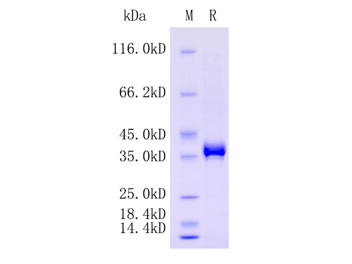 Human Galectin-4, Tag Free Protein (HA211468) – HUABIO