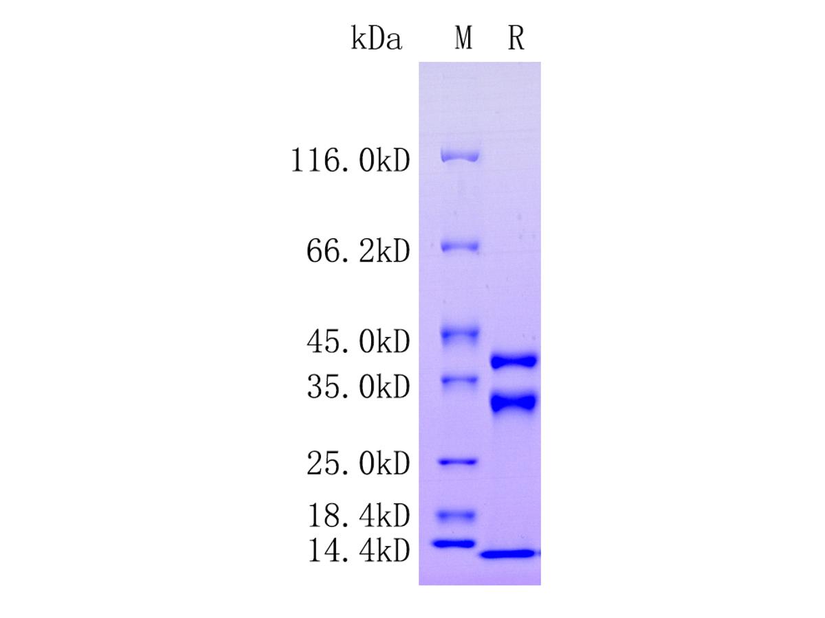 Human Cathepsin L / CTSL1, C-His Tag Protein (HA211475) – HUABIO