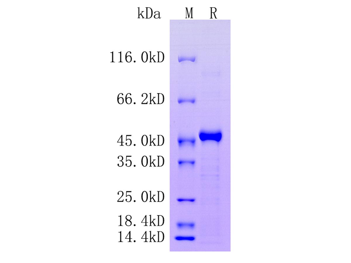 Human Ataxin-3/ATXN3, C-His Tag Protein (HA211529) – HUABIO