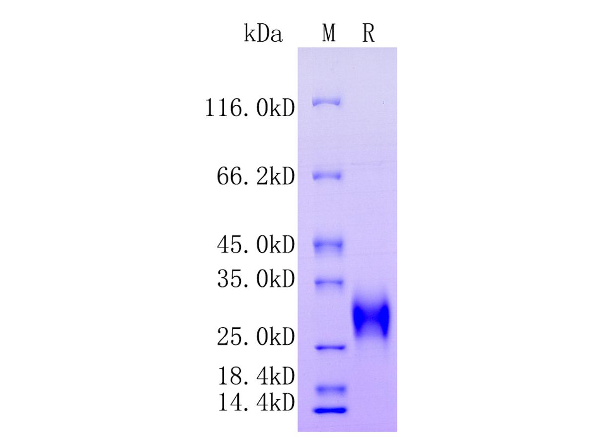 Human CD74 / DHLAG, C-His Tag Protein (HA211536) – HUABIO