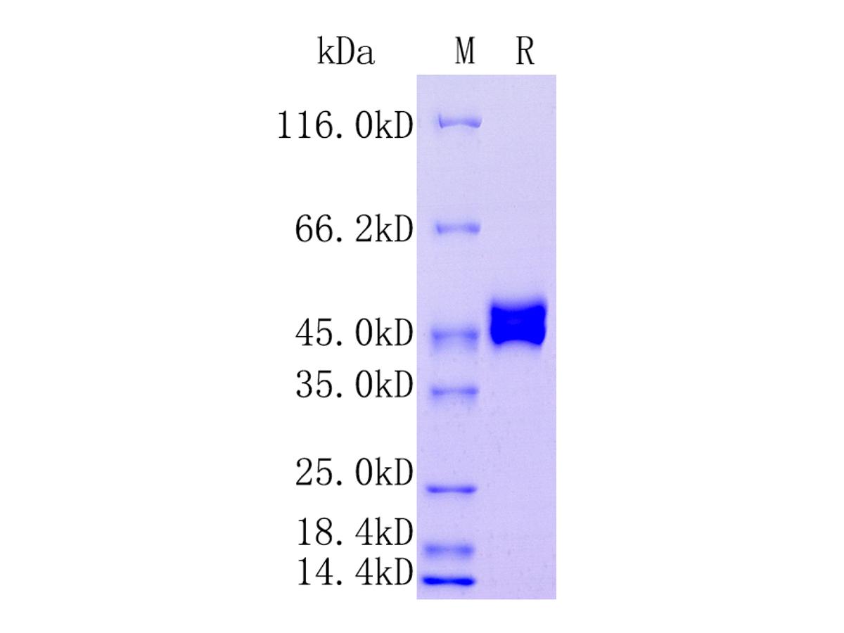 Human IgE Fc, Tag Free Protein (HA211545) – HUABIO