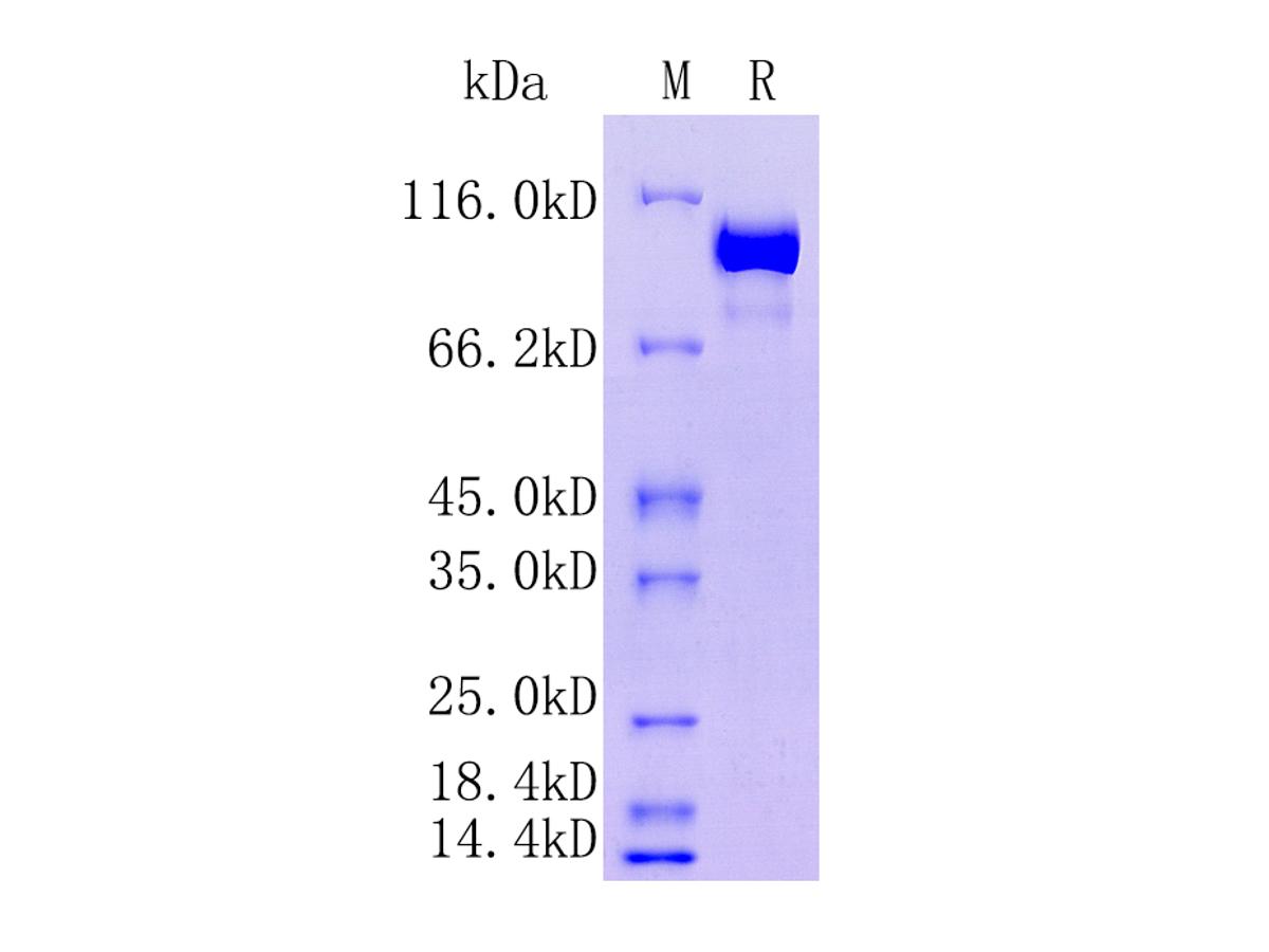 Human Complement C2, C-His Tag Protein (HA211546) – HUABIO