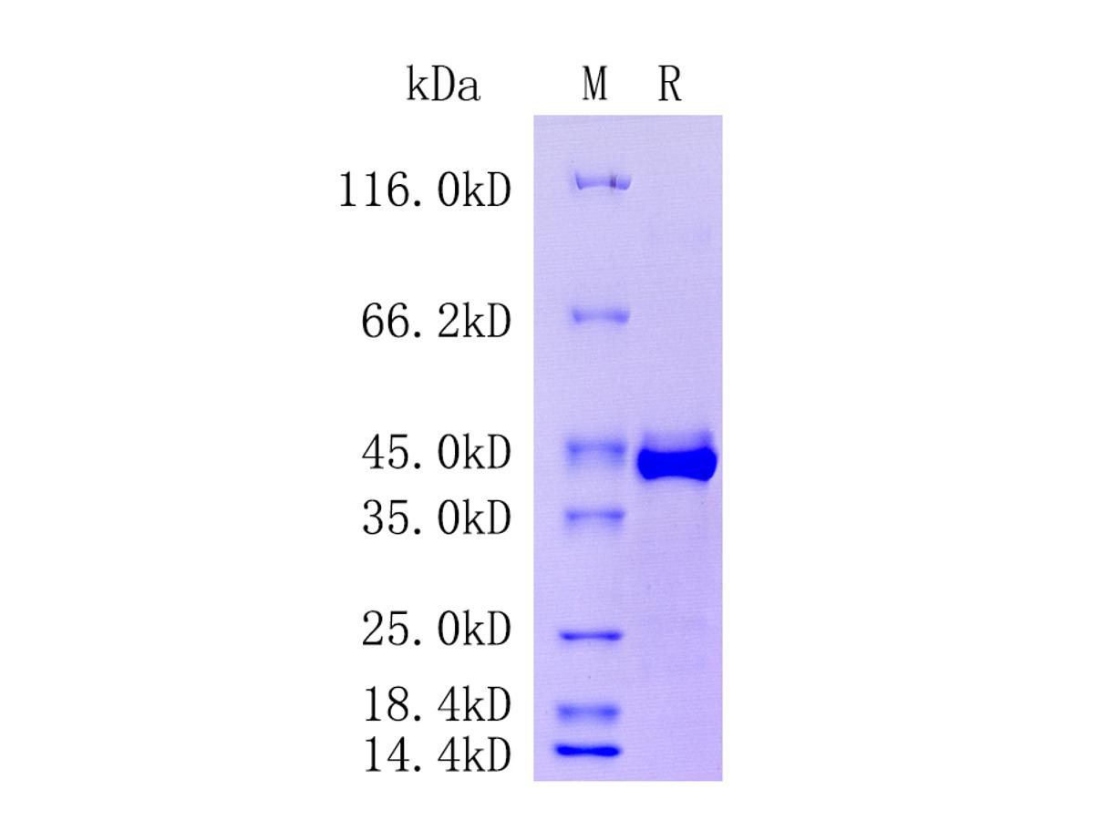 Human BRAK/CXCL14, C-hFc Tag Protein (HA211551) – HUABIO