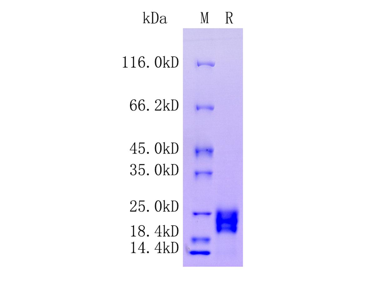 Human ESM1, Tag Free Protein (HA211552) – HUABIO